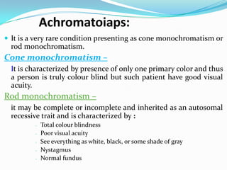 Color vision : introduction, classification, causes | PDF