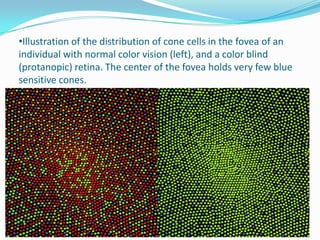 Color vision : introduction, classification, causes | PDF