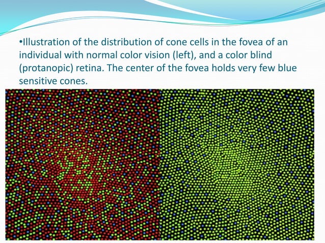 Color vision : introduction, classification, causes | PDF
