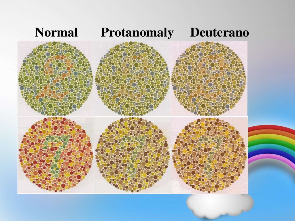 Colour Vision