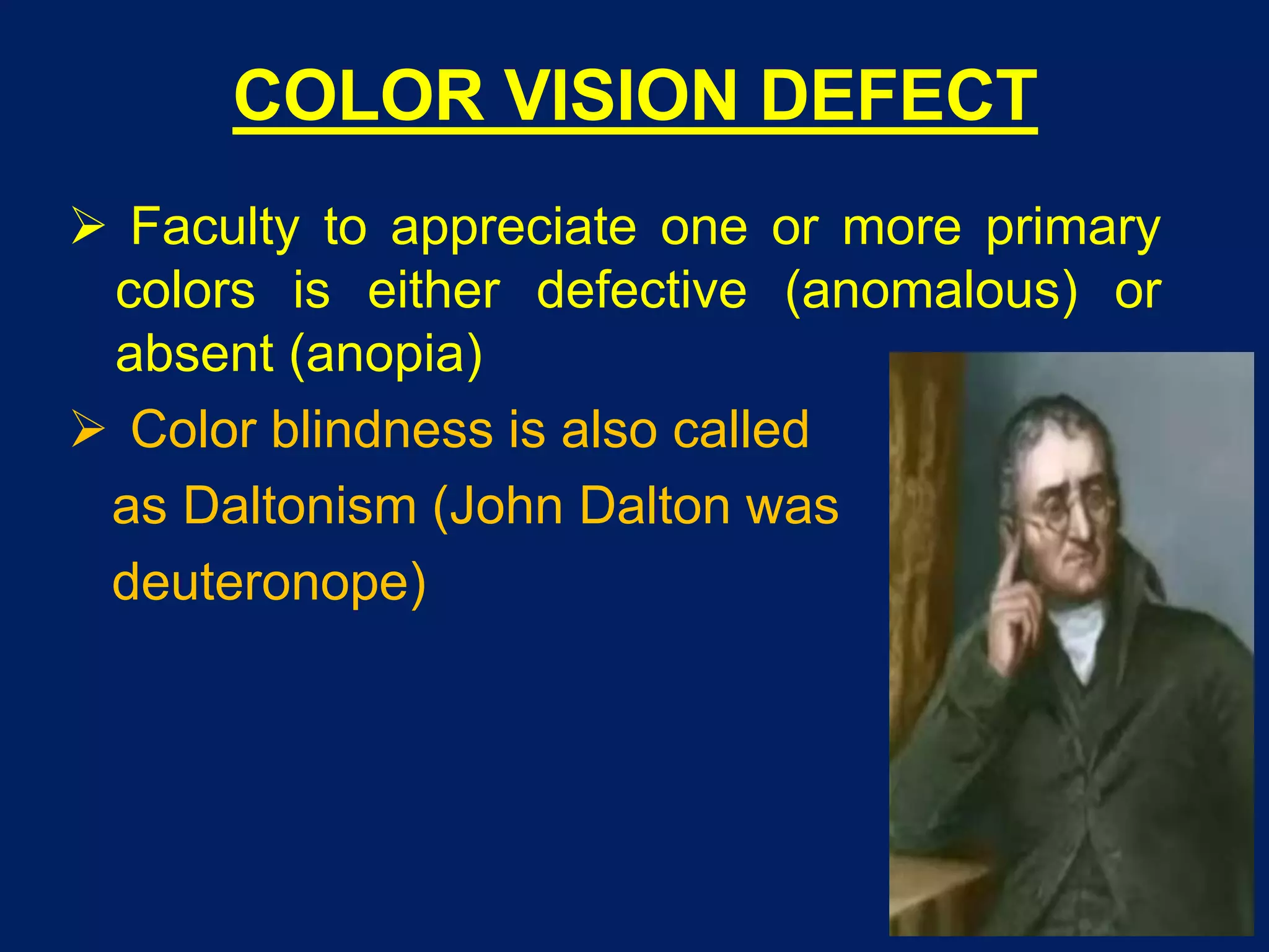 Color vision | PPT
