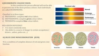 Colour vision & colour blindness | PPTX