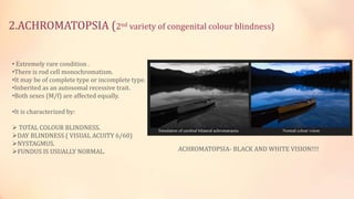 Colour vision & colour blindness | PPTX