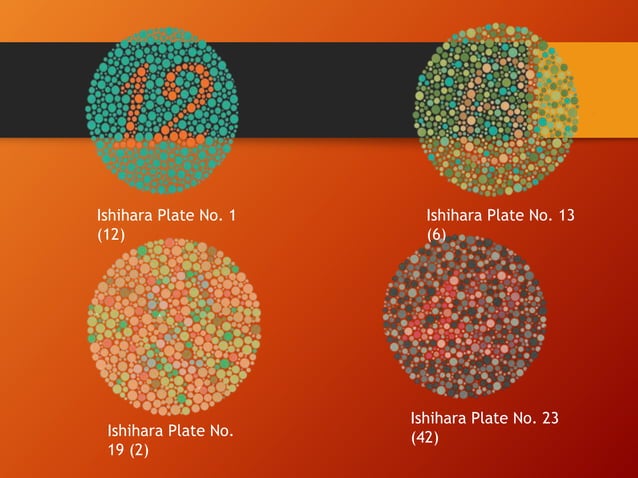 Colour vision examination | PPTX