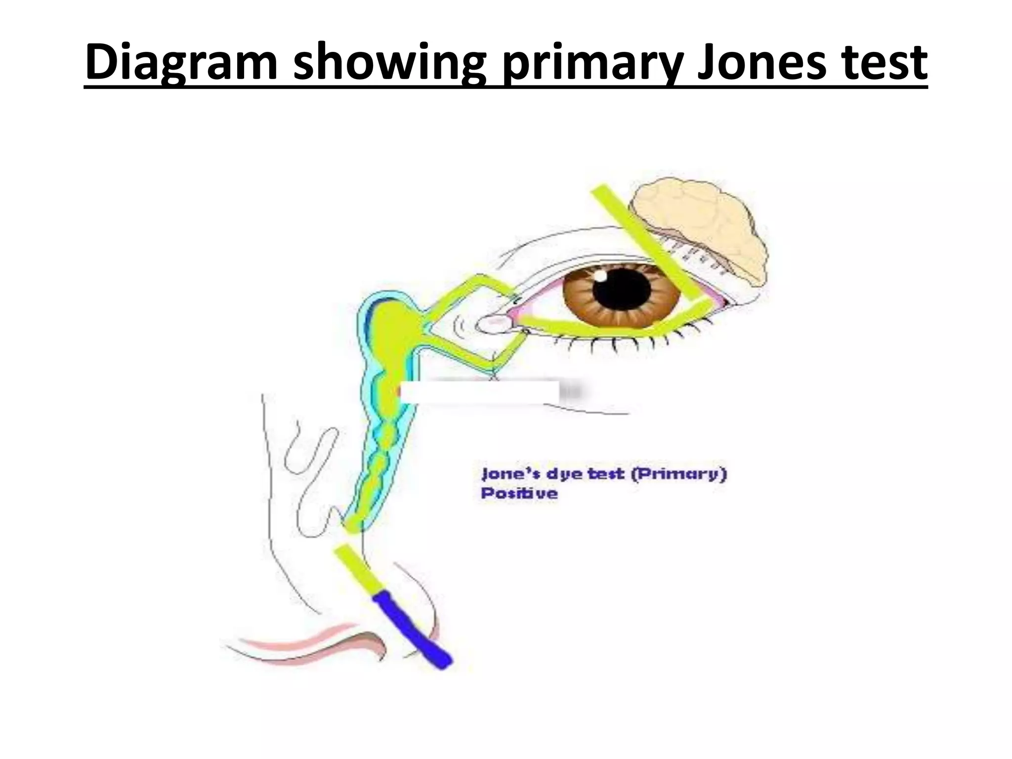 COLOUR VISION & LACRIMAL TESTS---13.pptx