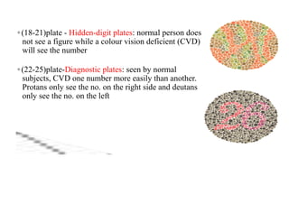 colour vision std.pdf, testing colour vision defects, diagnosis and ...