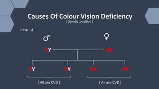 Colour Vison Deficency (CVD) | PPTX