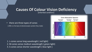 Colour Vison Deficency (CVD) | PPT