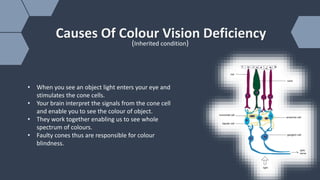 Colour Vison Deficency (CVD) | PPT