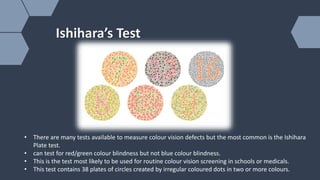 Colour Vison Deficency (CVD) | PPT