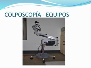Colposcopia | PPTX