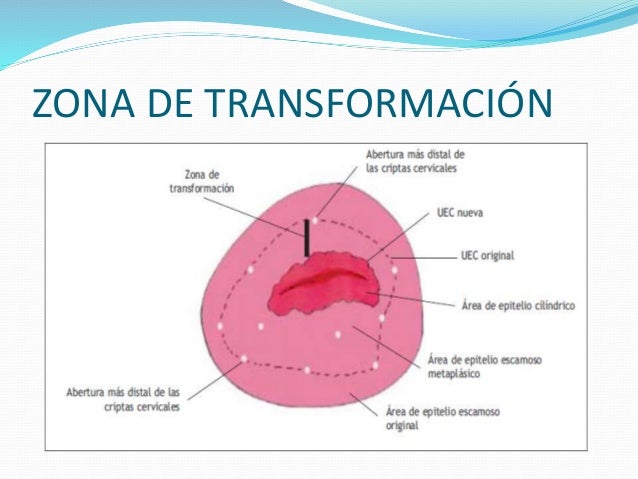 Colposcopia