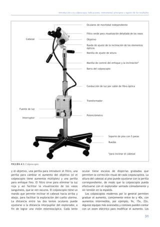 Colposcopia | PDF