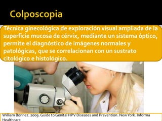 Colposcopia. Ginecologia. UMSNH | PPTX