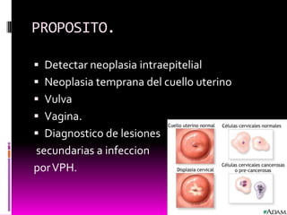 Colposcopia | PPTX