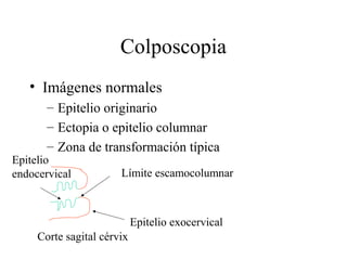 Colposcopia, principios de colposcopia. | PPT