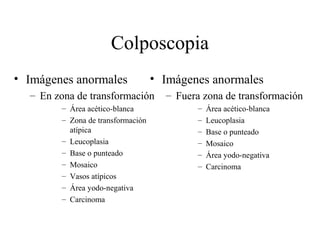 Colposcopia, principios de colposcopia. | PPT