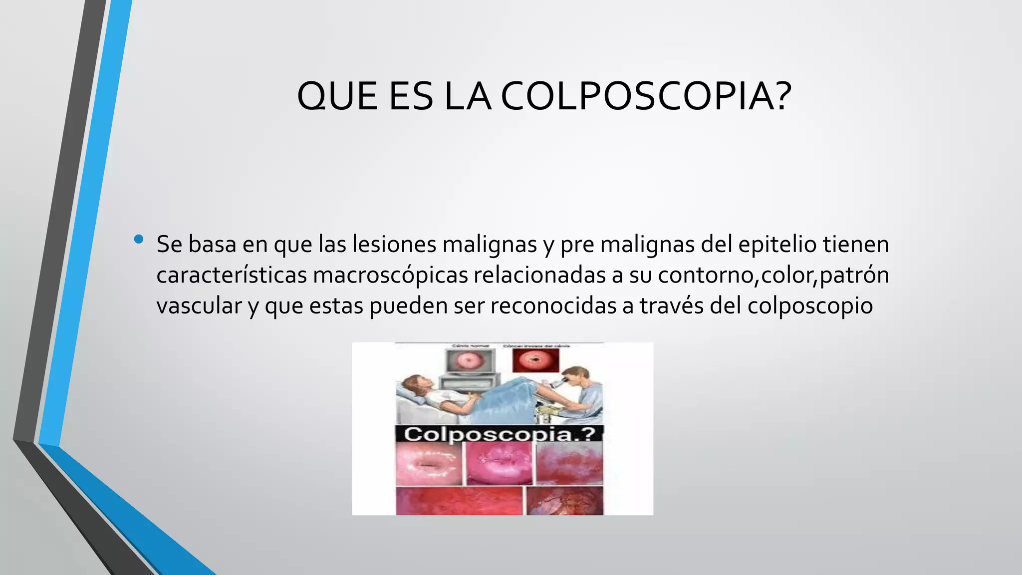 Enfermeria en colposcopia | PDF