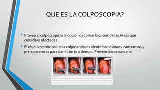 Enfermeria en colposcopia | PDF