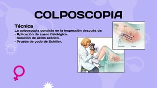 COLPOSCOPIA. VENEZUELA HOSPITAL RUIZ Y PAEZ pptx | PPTX