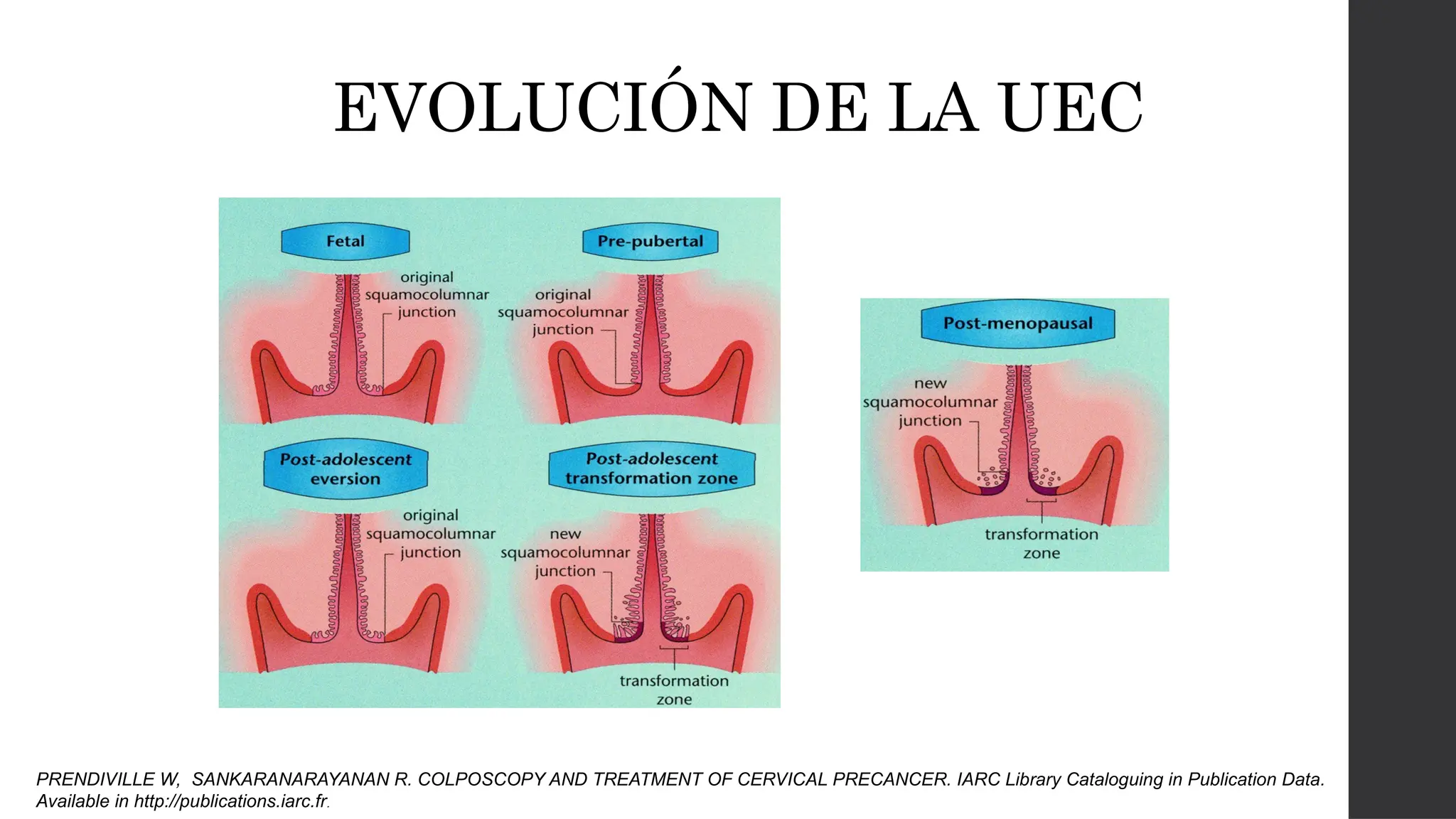 colposcopia de cervix como examen de tamizaje | PPTX