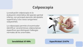 Colposcopia GENERALIDADES DEL TEMA...... | PPTX
