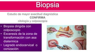 Colposcopia | PPTX