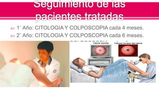 Colposcopia | PPTX