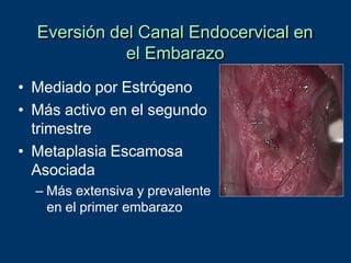 COLPOSCOPIA EN EL EMBARAZO COMO PREVENCION DEL VPH | PPTX