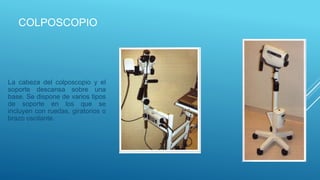 Colposcopio y técnica colposco displasias.pptx