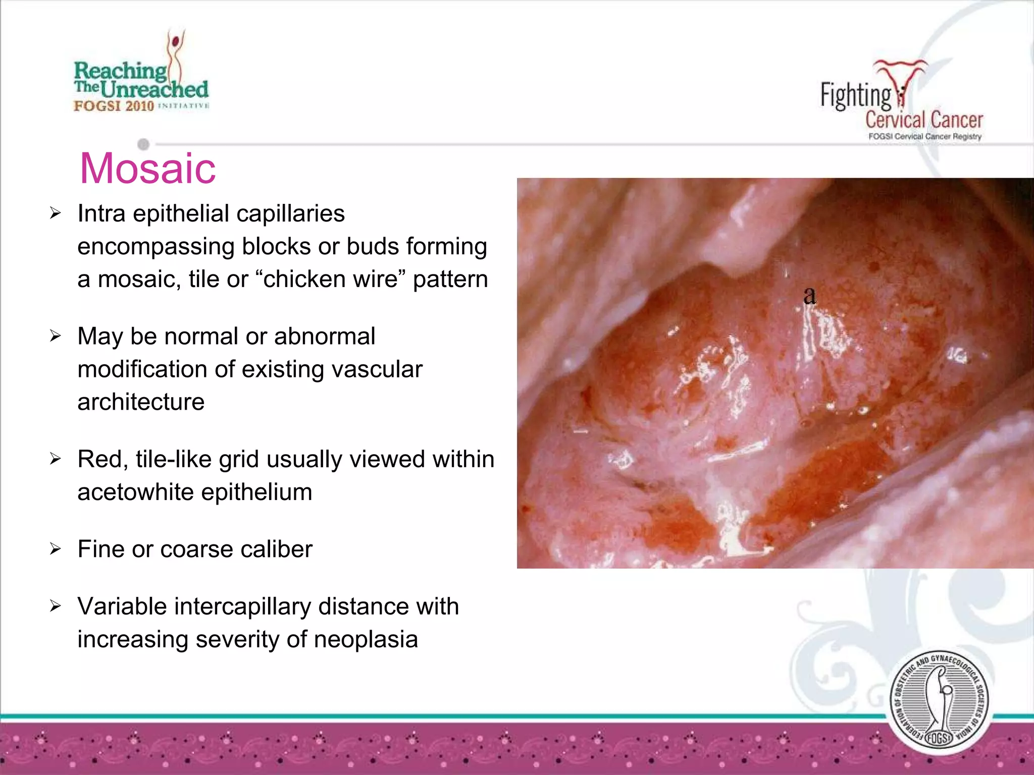 Colposcopy | PPT