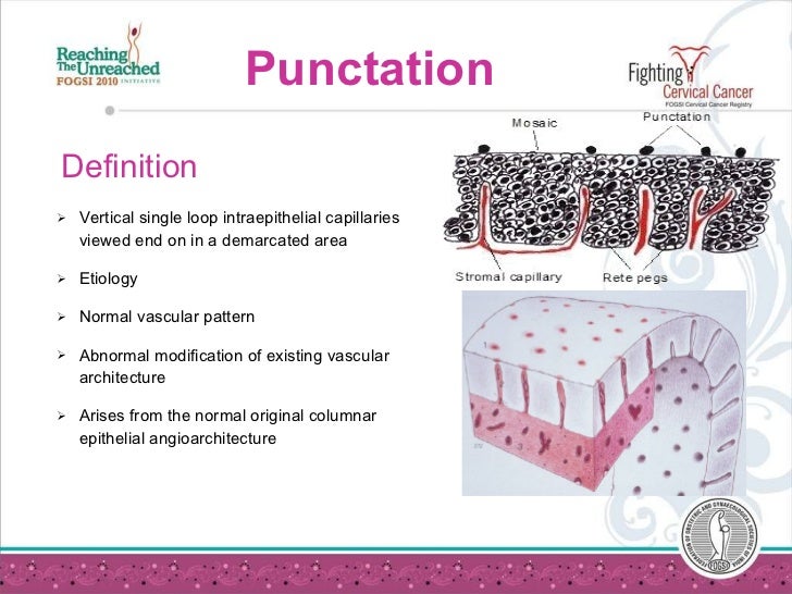 Colposcopy