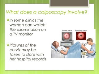 colposcopy-140720235313-phpapp01.pdf