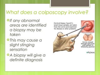 Colposcopy | PPT