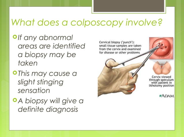 Colposcopy | PPT | Reproductive Health | Diseases and Conditions