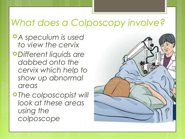Colposcopy
