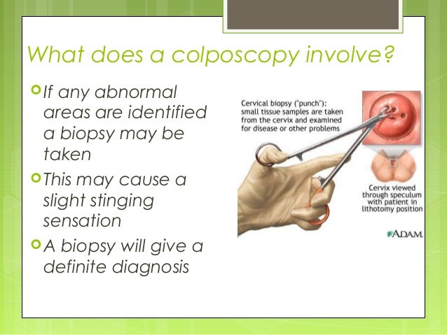 Colposcopy