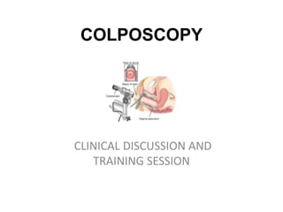 Colposcopy | PPTX