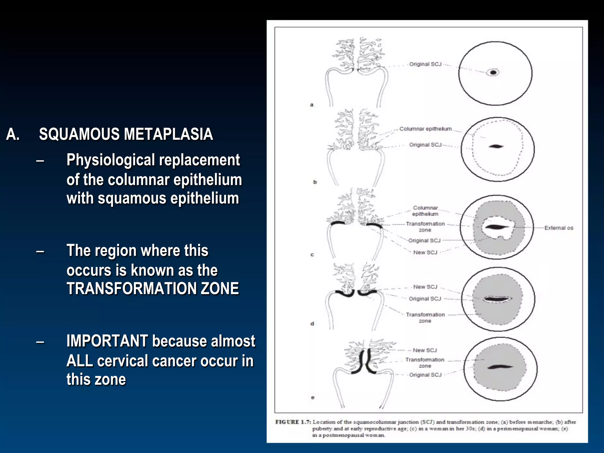 Colposcopy case studies2 | PDF