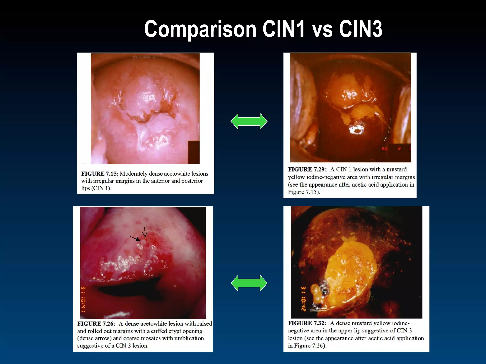 Colposcopy case studies2 | PDF