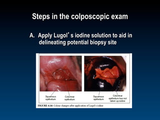 Colposcopy case studies2 | PDF