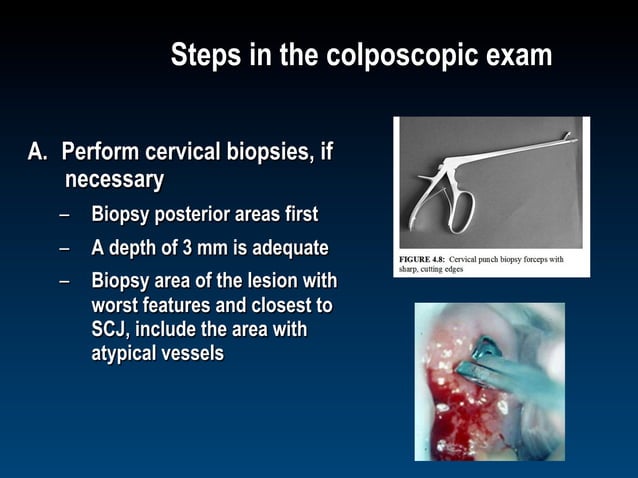 Colposcopy case studies2 | PDF