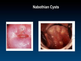 Colposcopy case studies2 | PDF