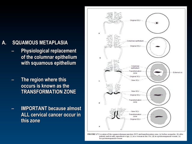 Colposcopy case studies2 | PDF