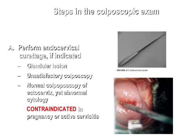 Colposcopy case studies2