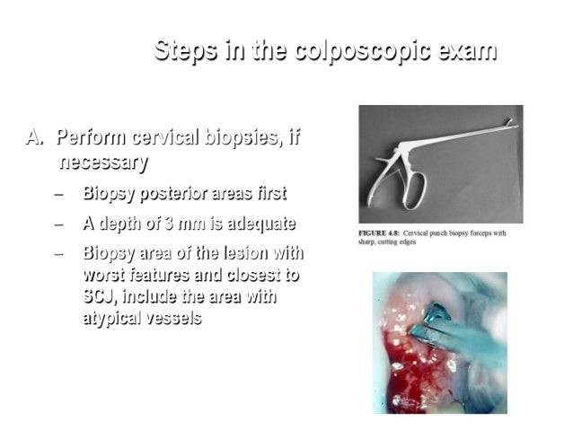 Colposcopy case studies2