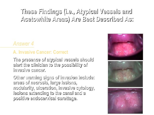 Colposcopy case studies2