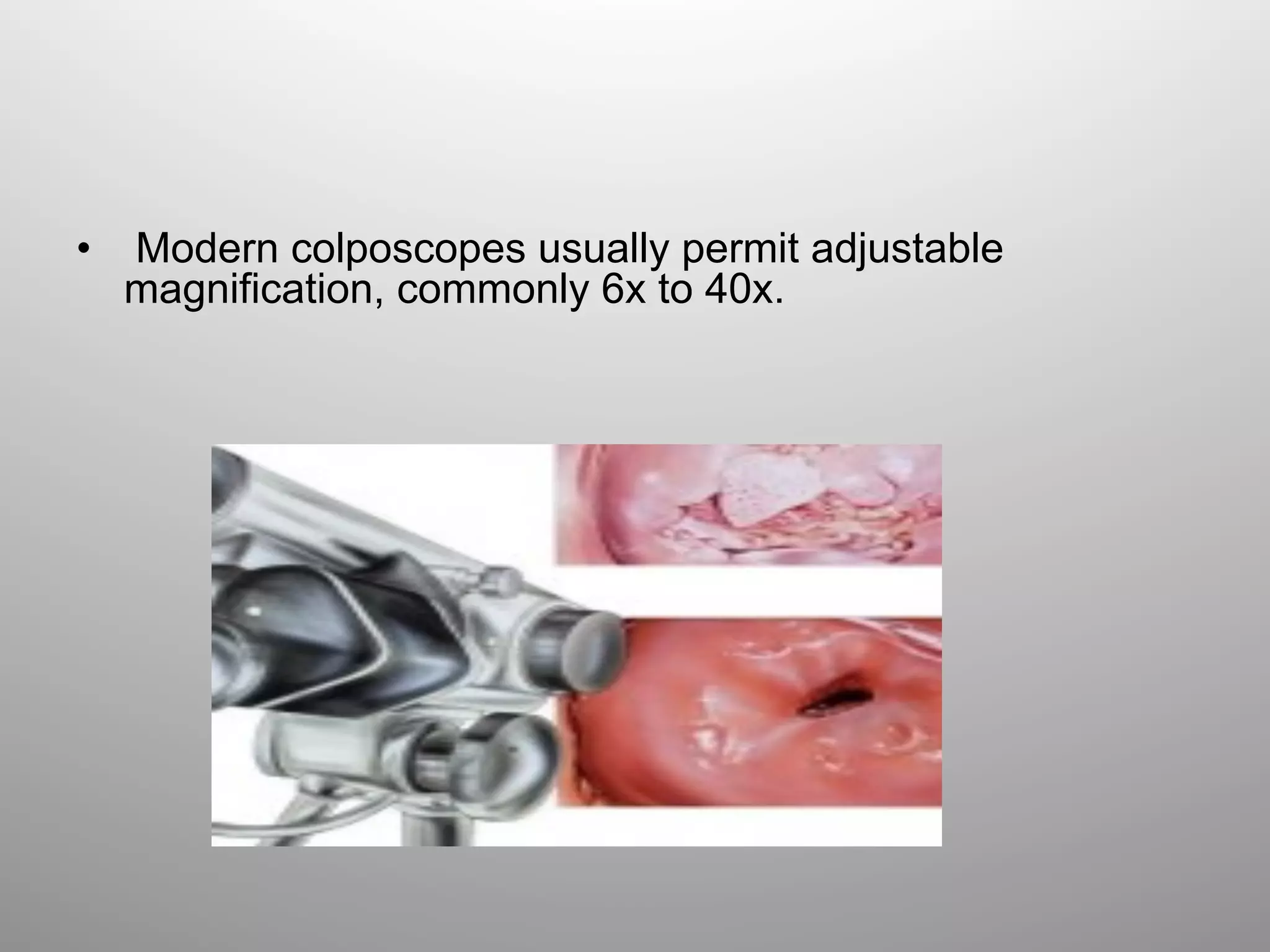 Colposcopy nstrumentation and principles on how to do 22 | PDF