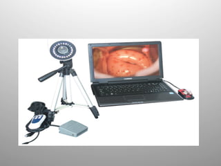 Colposcopy nstrumentation and principles on how to do 22 | PDF