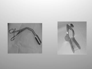 Colposcopy nstrumentation and principles on how to do 22 | PDF